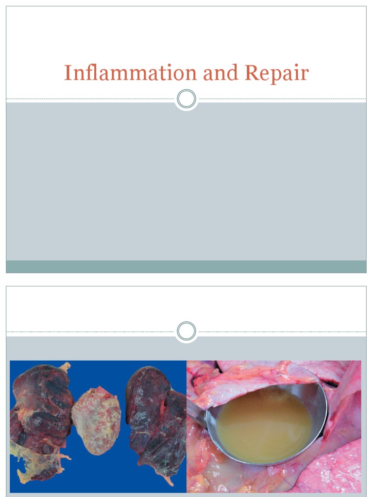 Chapter 2 Inflammation and Repair Pathoma | PDF