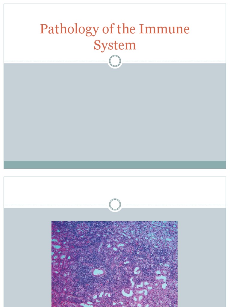 Chapter 3 Pathology of The Immune System Pathoma | PDF