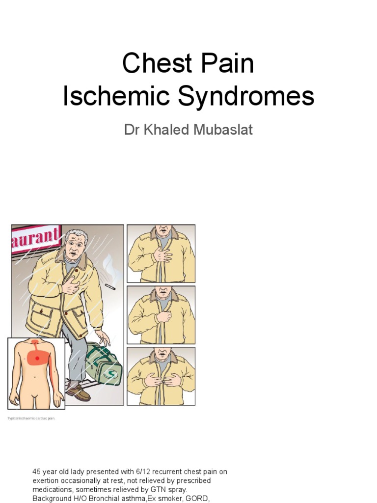Chest Pain - Ischemic Syndromes | PDF