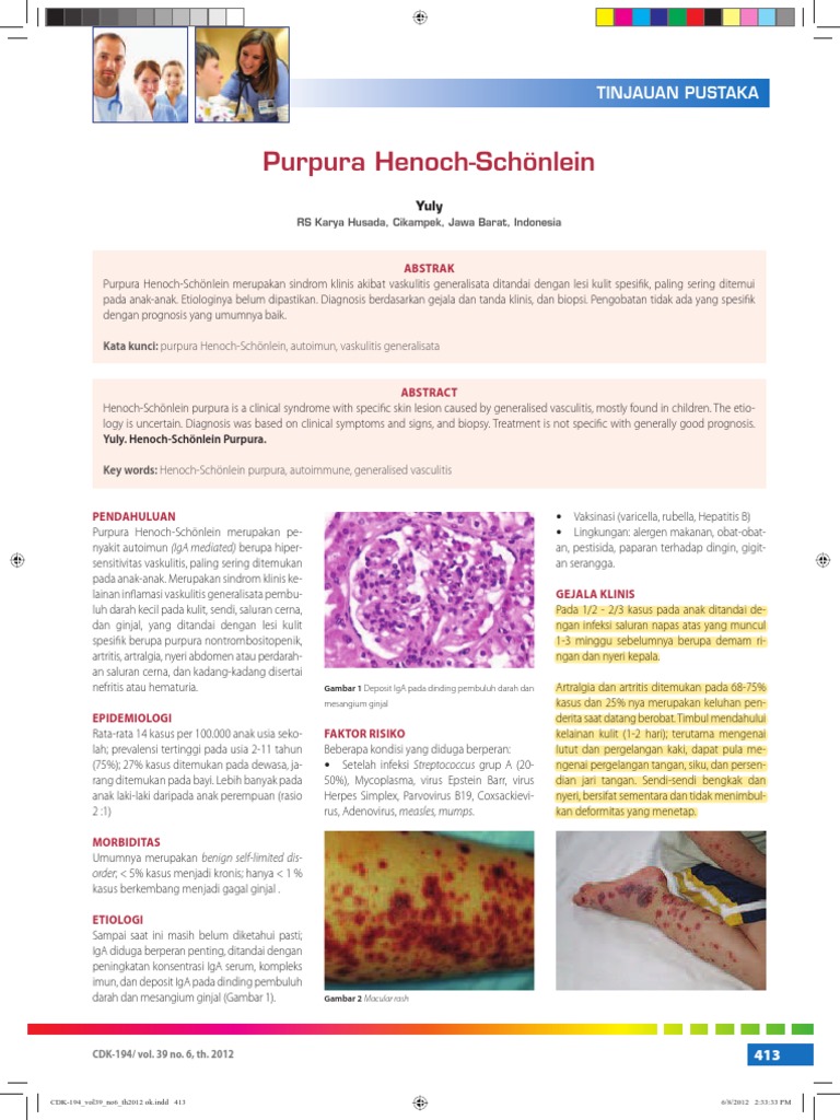 Purpura Henoch Schonlein | PDF