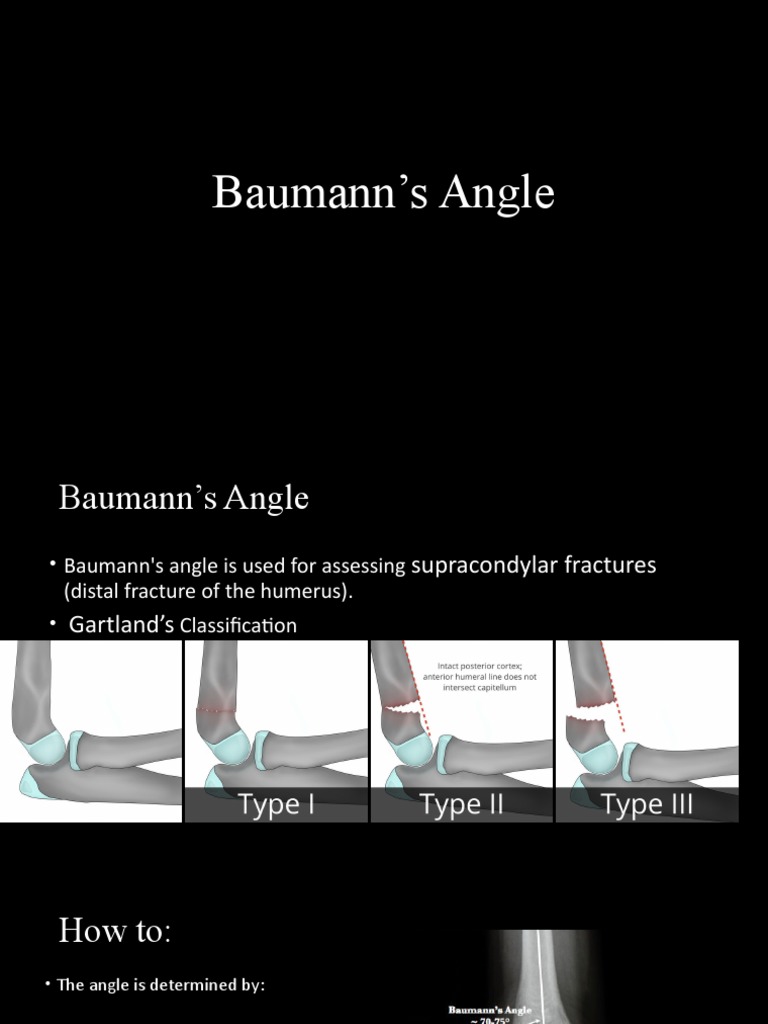 Baumann's Angle | Download Free PDF | Biomechanics | Musculoskeletal System