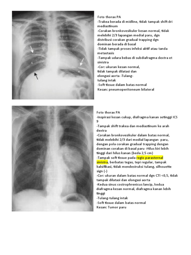 Latihan Thorax Radiologi | PDF