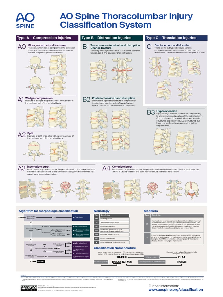 AOS Injury Classification Systems Poster THORACOLUMBAR | PDF | Vertebra | Vertebral Column
