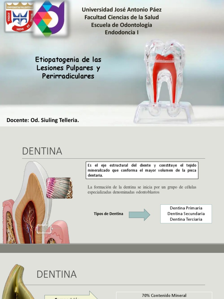 Etiopatogenia de las Lesiones Pulpares y Perirradiculares | PDF ...