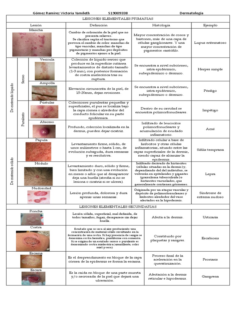 Lesiones Elementales | PDF | Piel | Epidermis