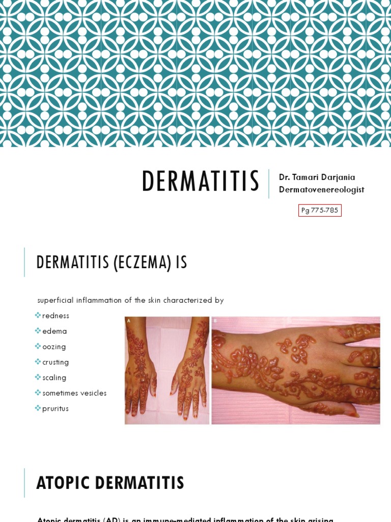 Dermatitis | Download Free PDF | Dermatitis | Allergy