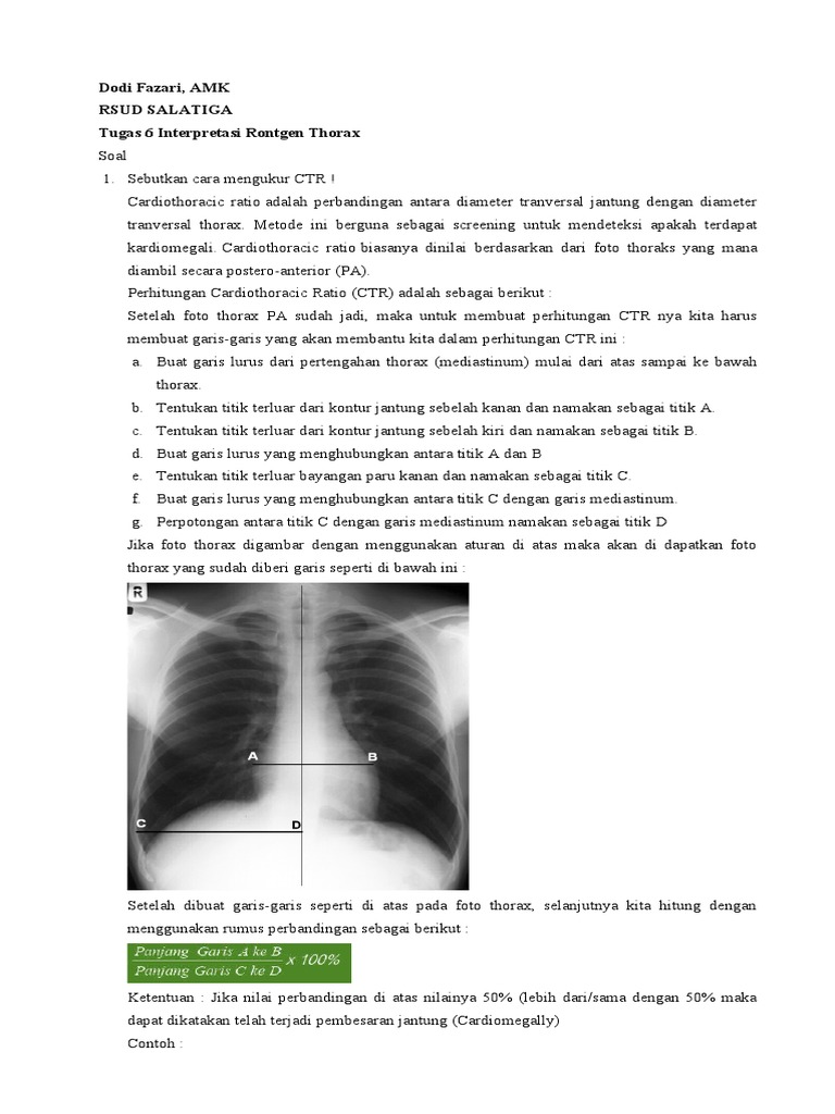 Tugas 6 Interpretasi Rontgen Thorax | PDF | Sains & Matematika