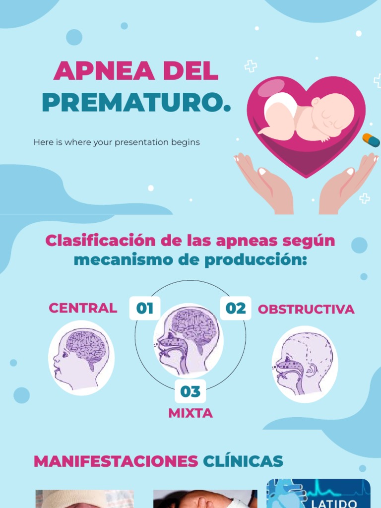 Clasificación y cuidados en apnea del prematuro | PDF