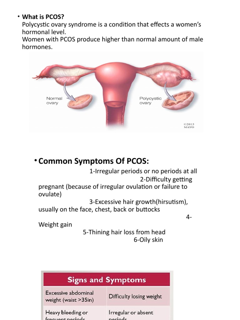 PCOS | PDF | Polycystic Ovary Syndrome | Medicine