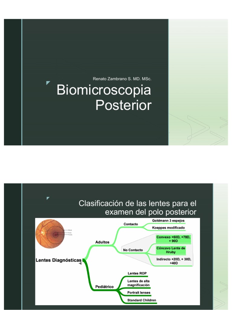 Biomicroscopia Posterior | PDF | Ojo humano | Percepción visual