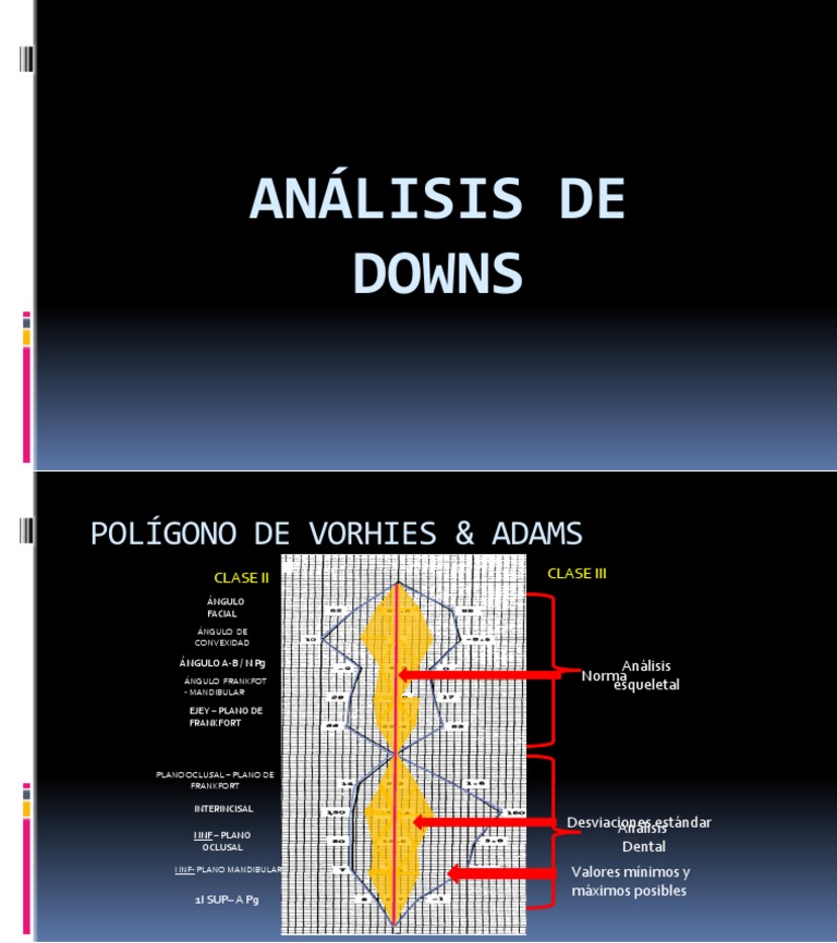 downs - poligono | PDF