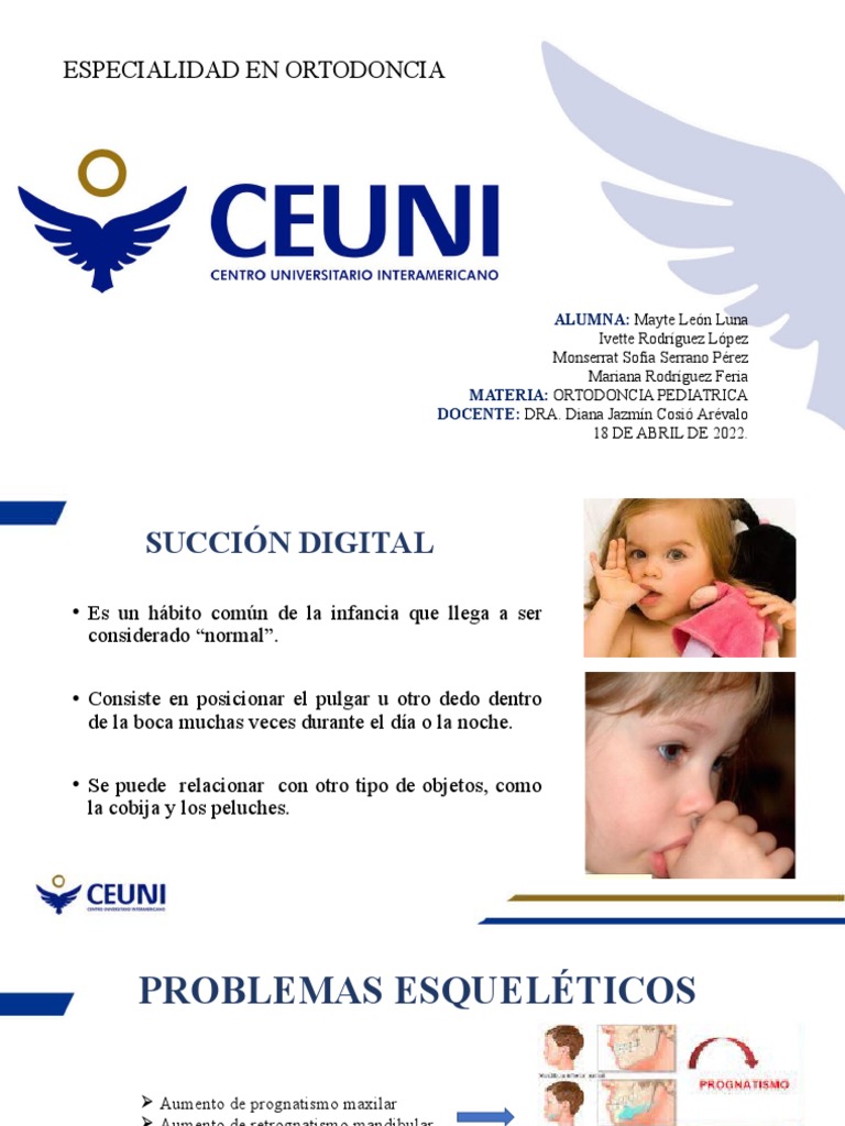 Succión Digital | PDF | Ortodoncia
