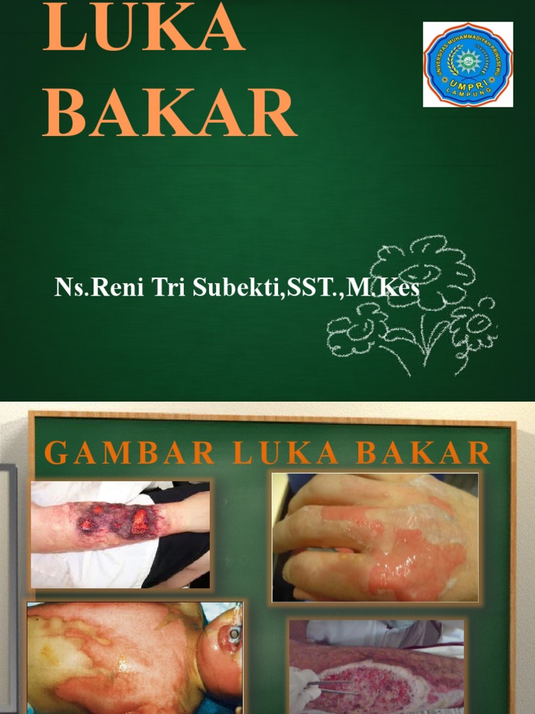 Luka Bakar | PDF
