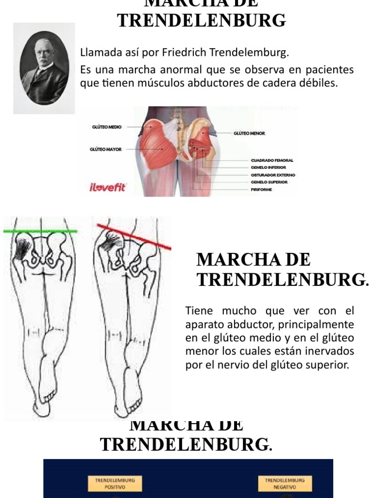 Marcha de Trendelenburg | PDF