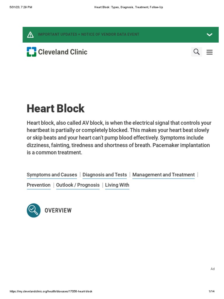 Heart Block - Types, Diagnosis, Treatment, Follow-Up | PDF | Heart ...