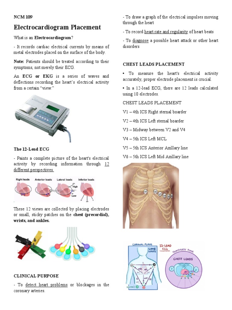 NCM 109 (ECG and Cardiac Monitoring) | PDF | Electrocardiography ...