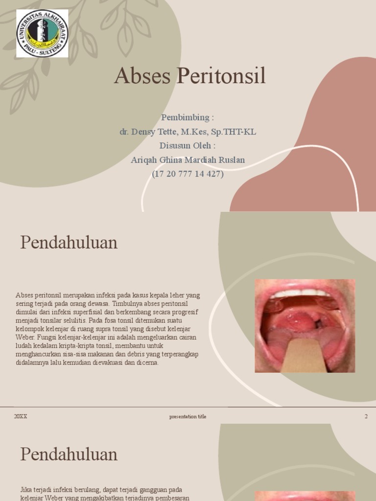 Tatalaksana Abses Peritonsil | PDF