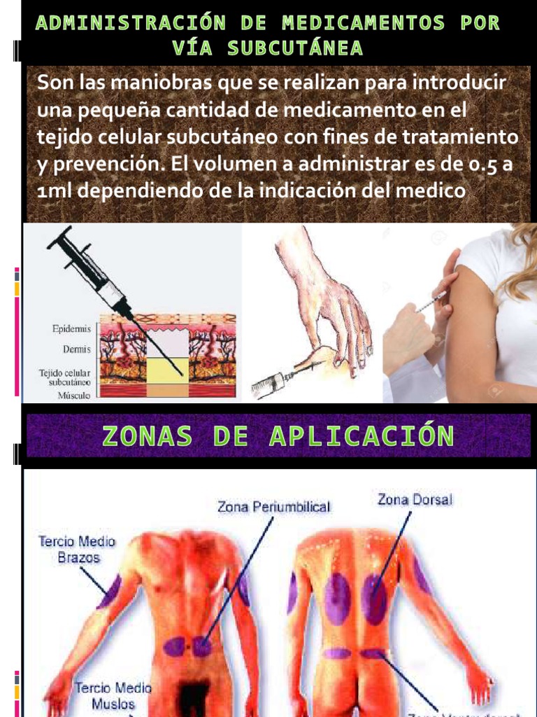 Administracion de Medicamentos Por Via Subcutanea 1 | PDF | Inyección ...
