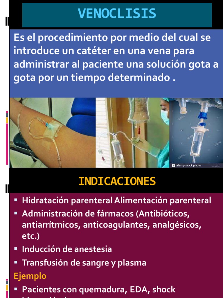 Procedimiento de Venoclisis y Transfusión | PDF | Sangre | Transfusión ...