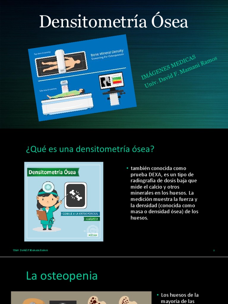 Densitometría Ósea | PDF | Osteoporosis | Epidemiología