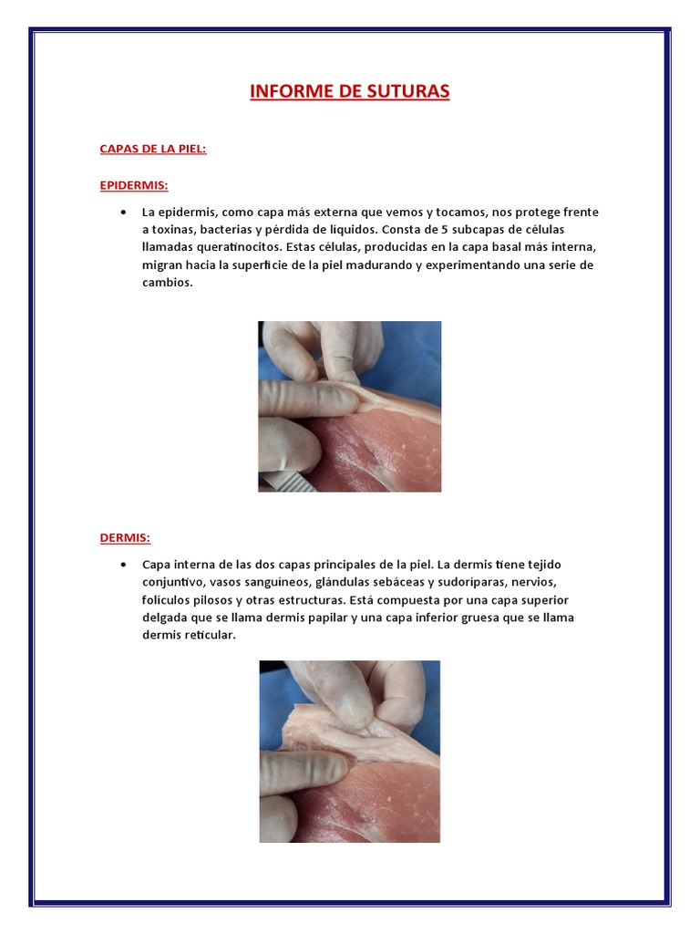 Tipos de Suturas en Capas de Piel | PDF | Piel | Epidermis