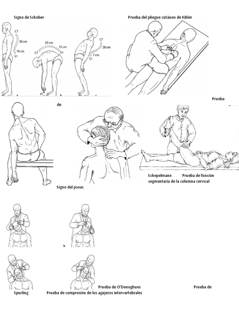 Signo de Schober | PDF