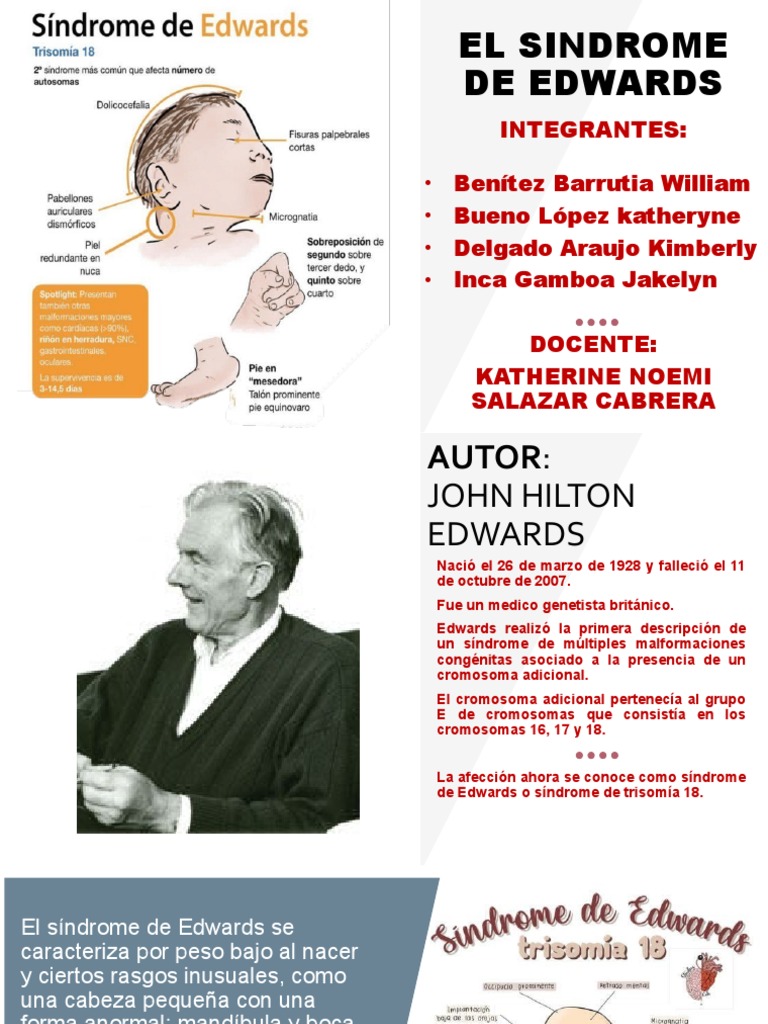 El Sindrome de Edwards | PDF | Enfermedades y trastornos humanos ...