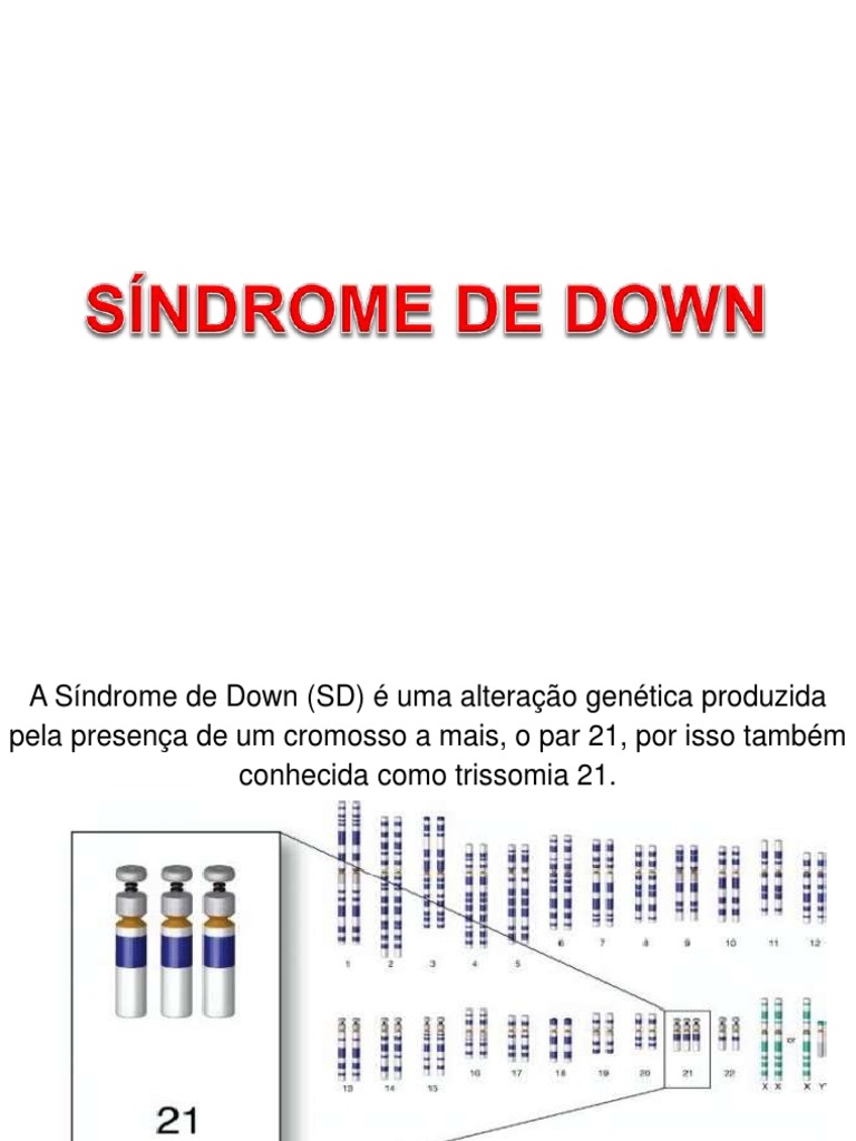 Síndrome de Down 2 - Ped Ii | PDF | Síndrome de Down | Gene