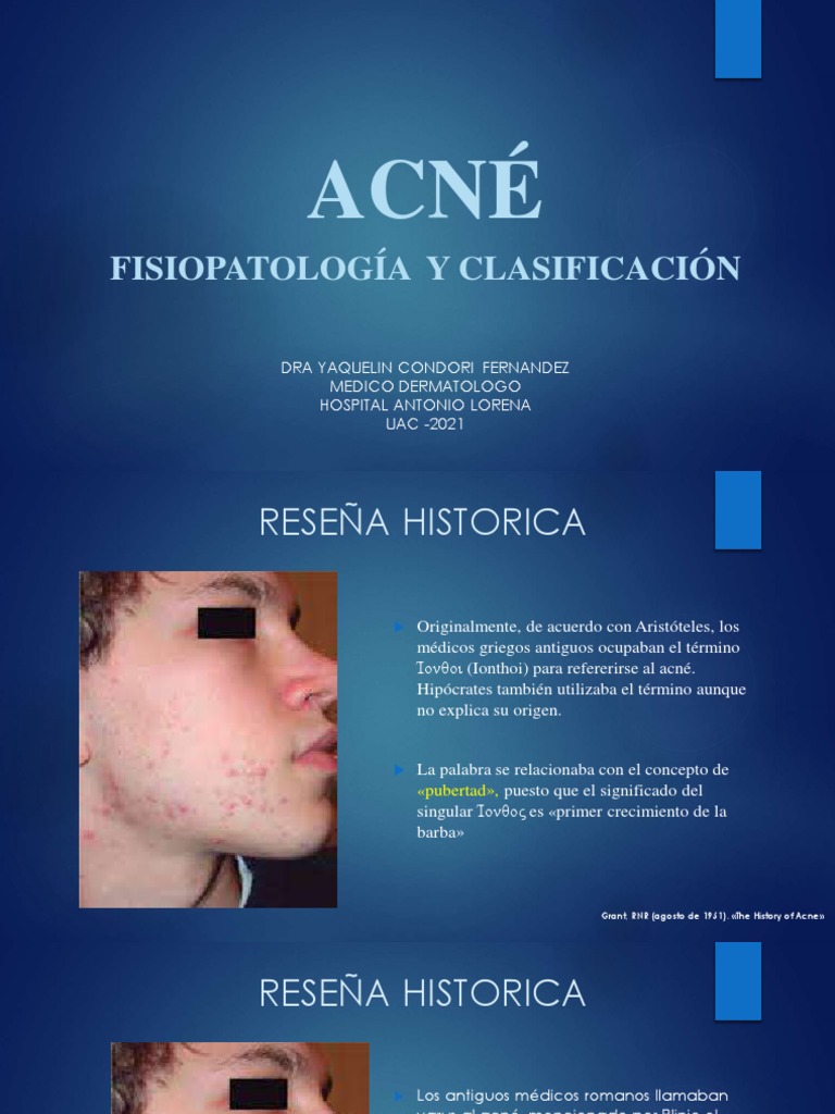 Acne Fisiopatologia Uac Pdf Inflamación Órgano Anatomía