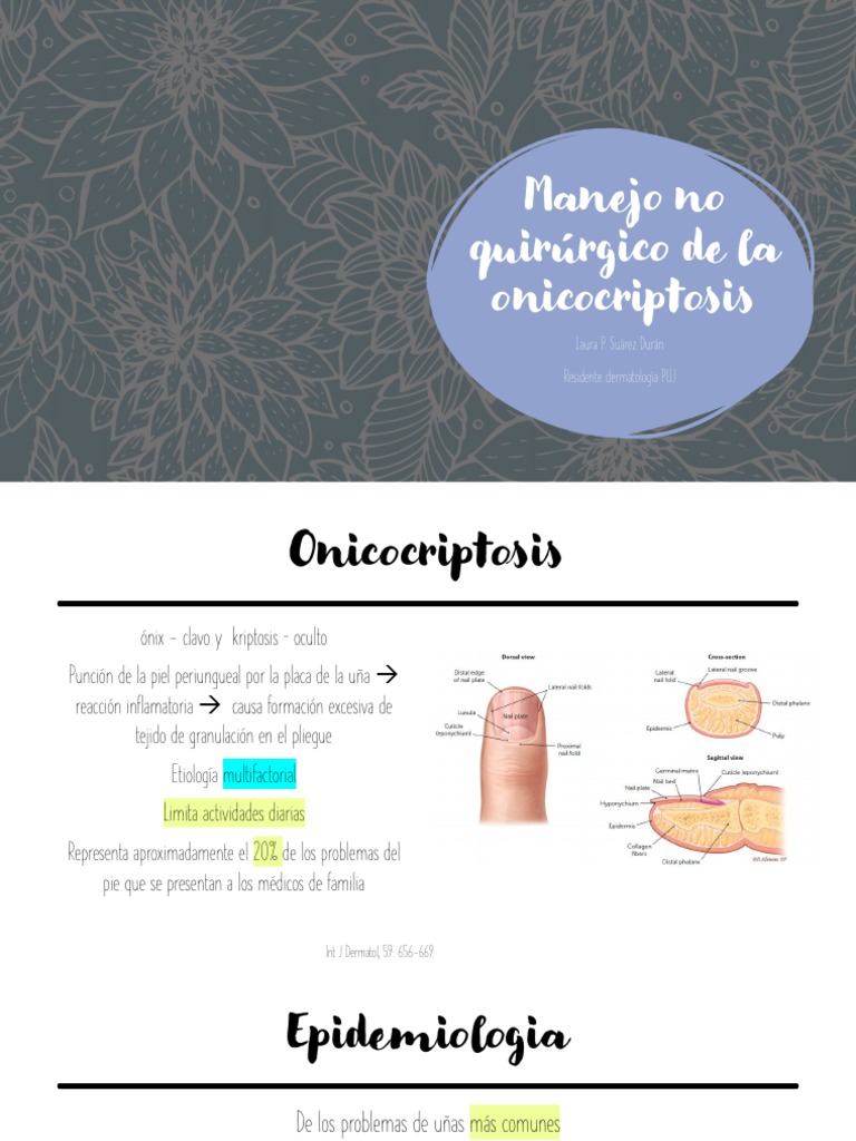 Manejo No Quirugico de La Onicocriptosis | PDF | Clavo (anatomía ...
