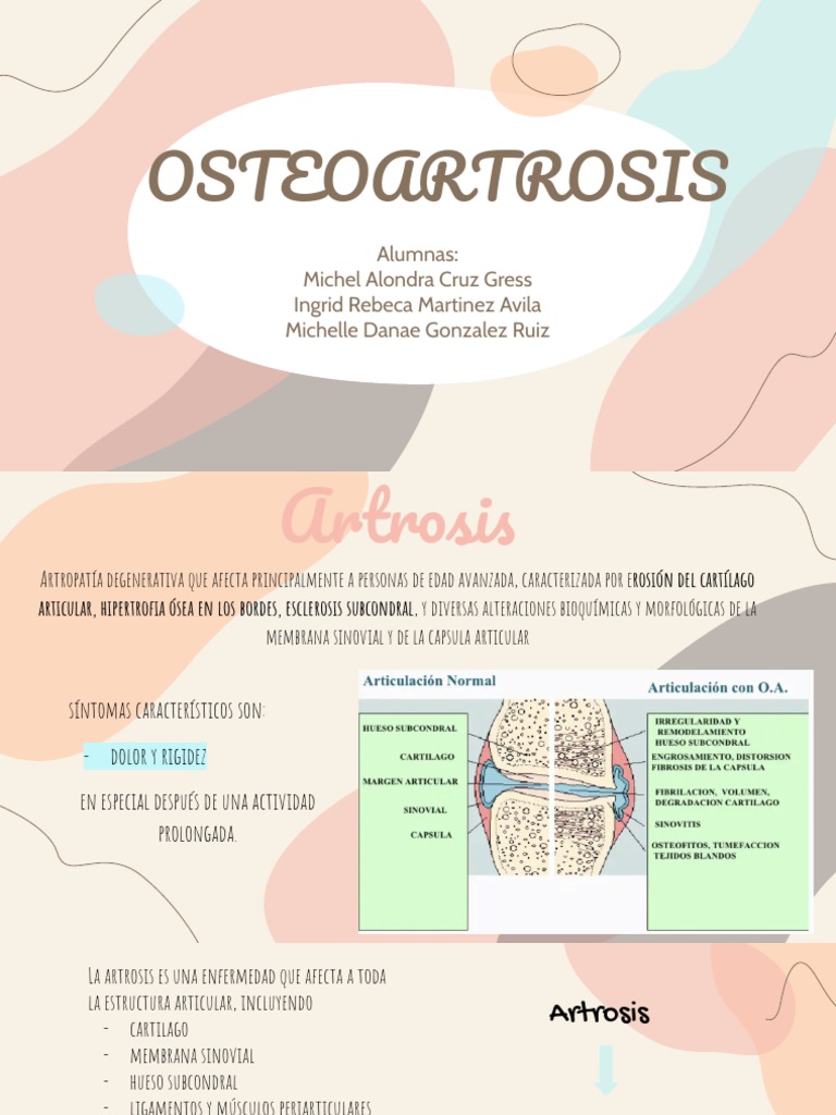 Osteoartrosis | PDF