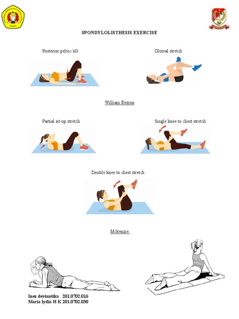Spondylolisthesis Exercise | PDF