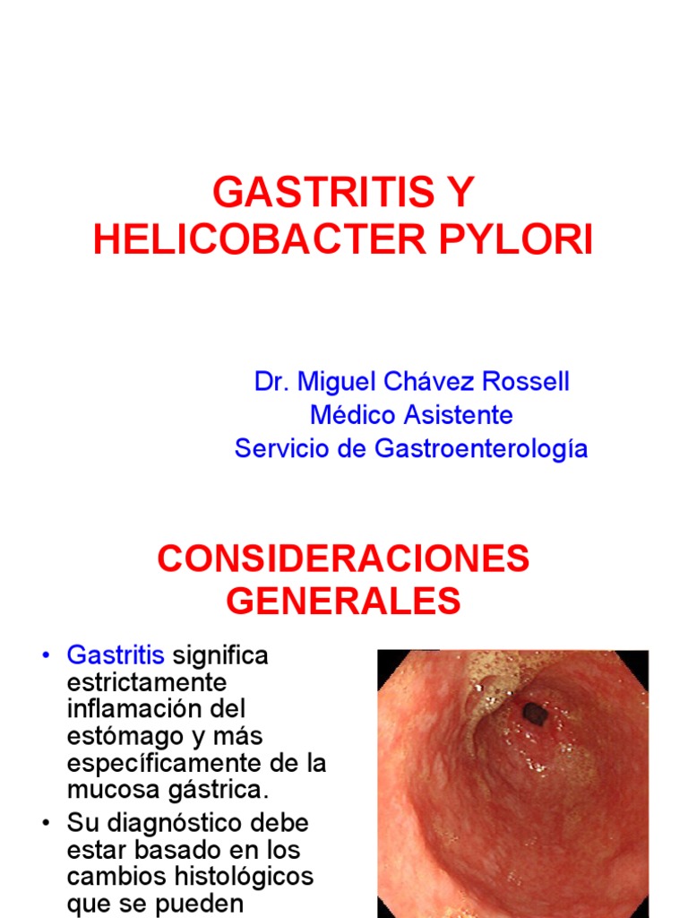 Gastritis y Helicobacter Pylori 1213219533516596 9 | PDF | Indigestión ...