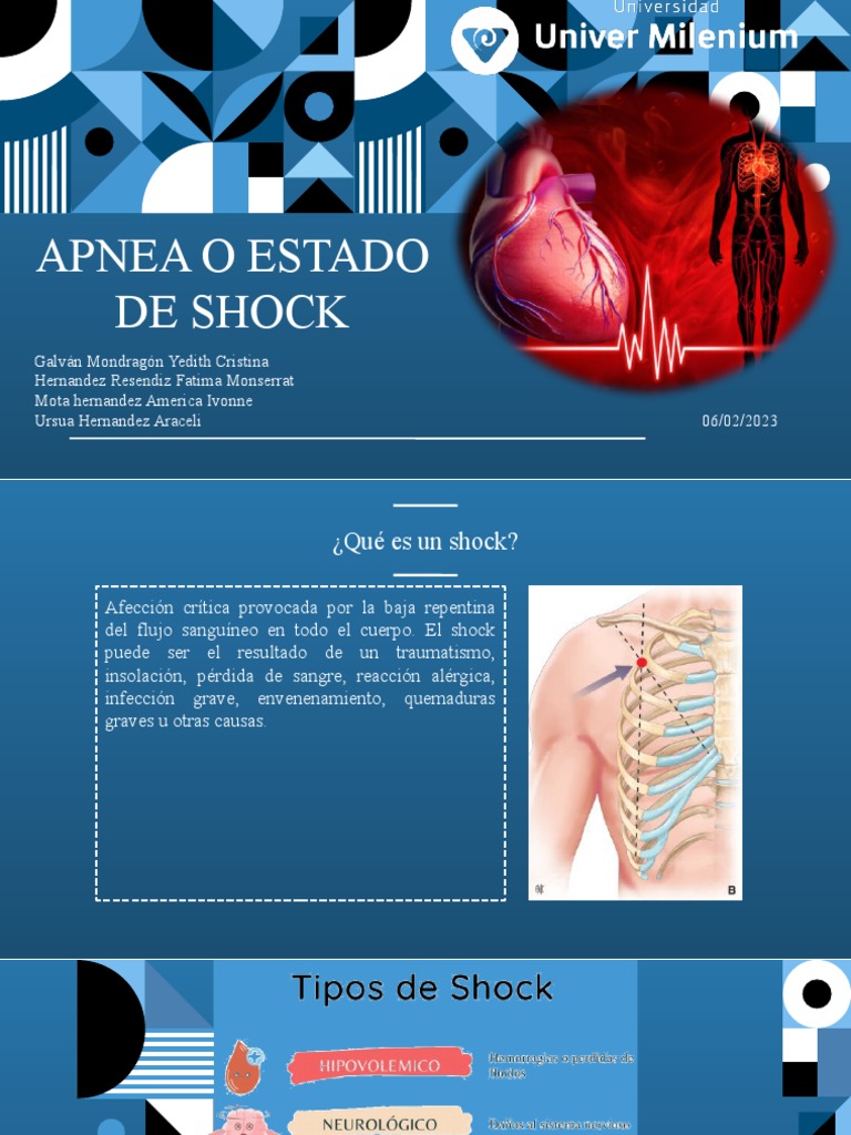 Tipos de Shock | PDF | Choque (circulatorio) | Epidemiología