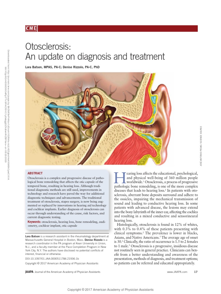 Otosclerosis An Update On Diagnosis and Treatment.3 | PDF | Hearing Loss | Ear