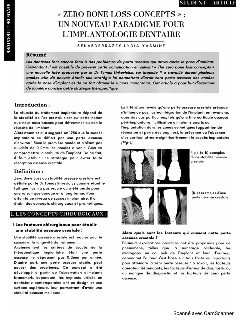 Zero Bone Loss Concepts Article | PDF