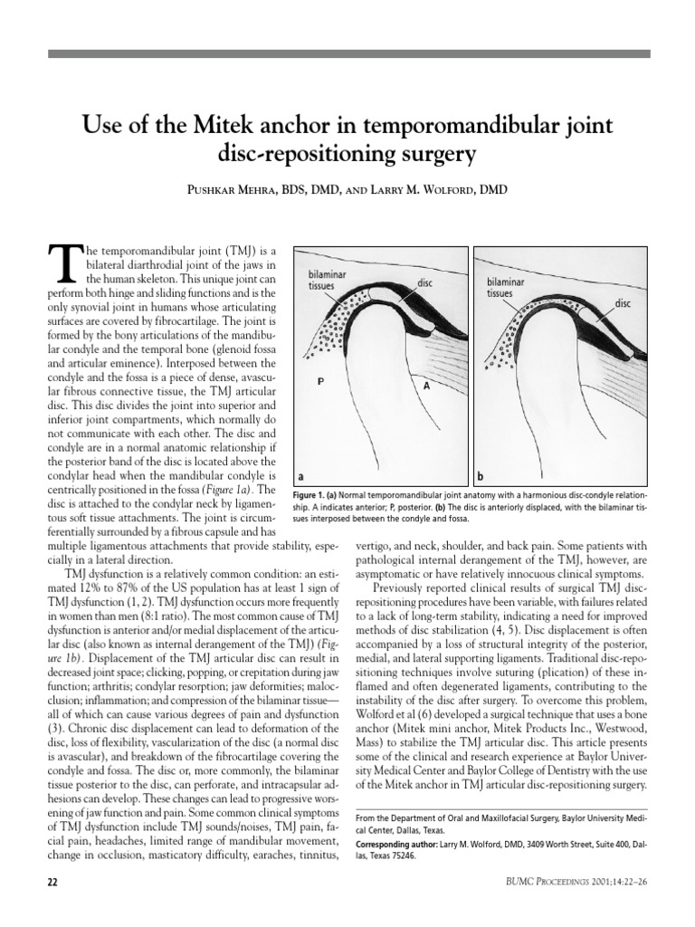 Use of The Mitek Anchor in Temporomandibular Joint Disc Repositioning ...