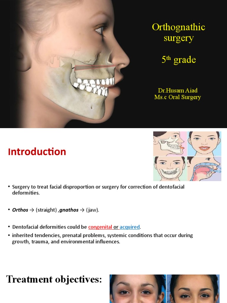 Overview of Orthognathic Surgery | PDF | Clinical Medicine | Human Head ...