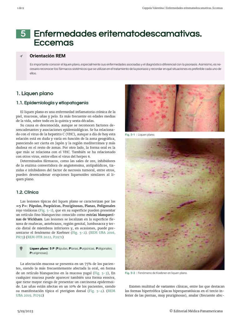 Eritematodescamativas, Eccemas | PDF | Psoriasis | Alergia