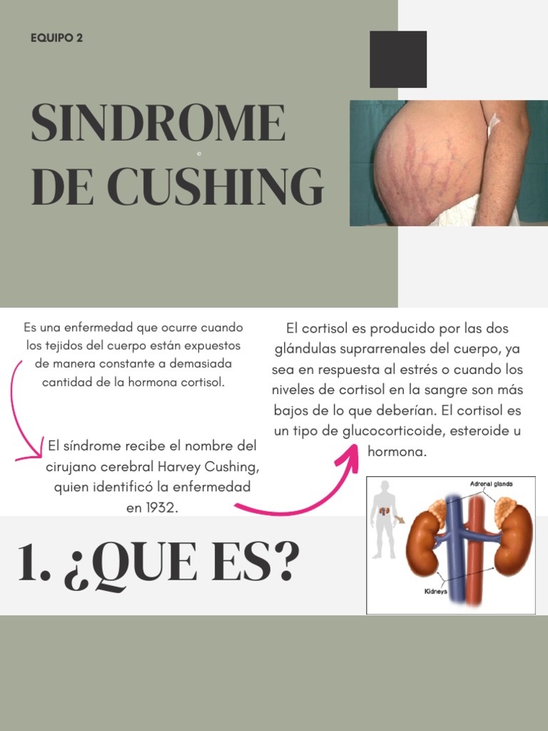 Sindrome de Cushing | PDF