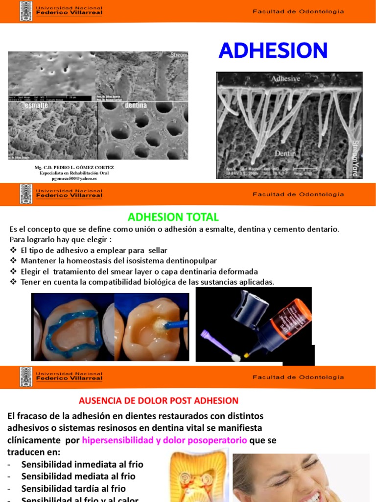2 ADHESION. Sistemas Adhesivos | PDF | Dentina | Esmalte de dientes