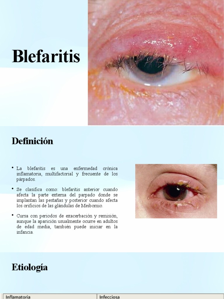 Blefaritis | PDF | Enfermedades y trastornos | Especialidades Medicas