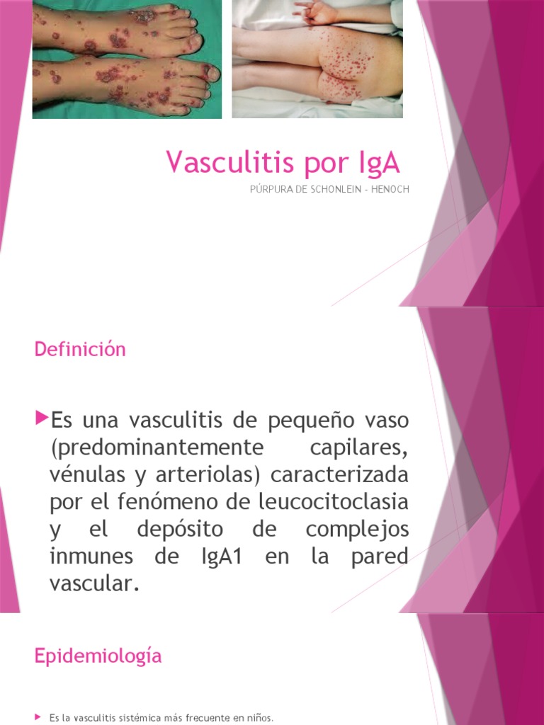 Vasculitis Por IgA | PDF | Especialidades Medicas | Medicina CLINICA