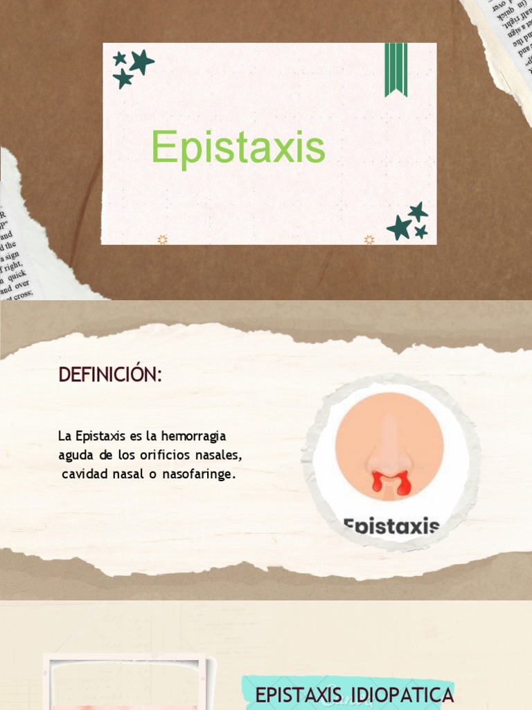 Clasificación y manejo de epistaxis | PDF | Tratamientos médicos ...