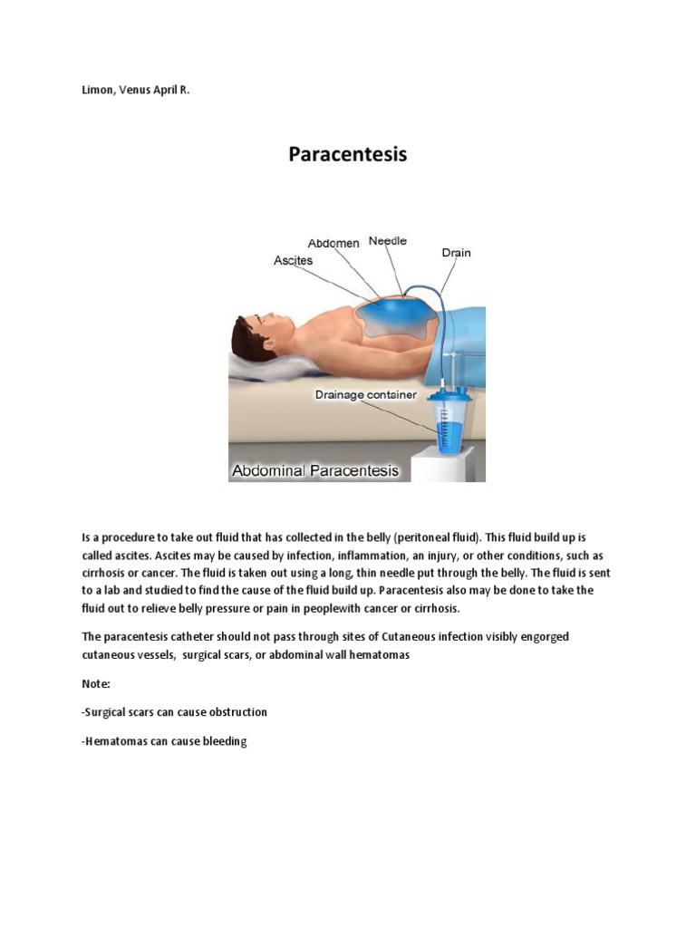 Paracentesis | PDF | Surgery | Anesthesia