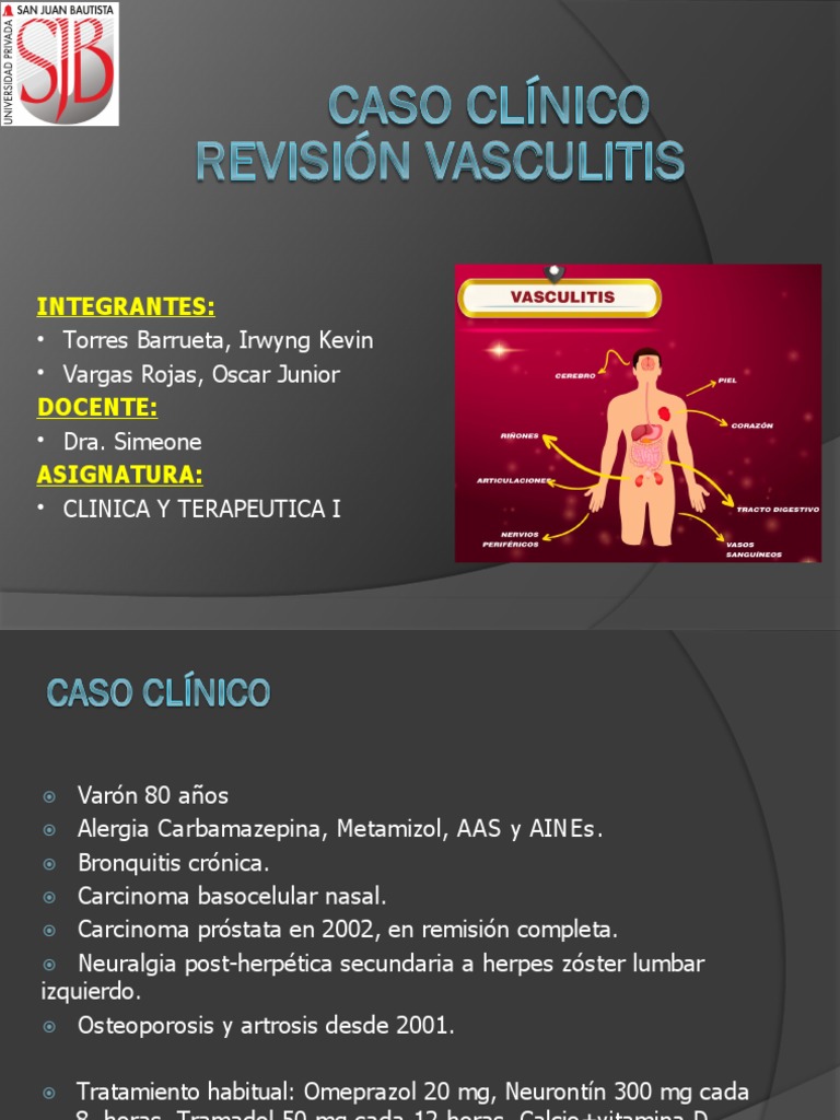 VASCULITIS | PDF | Ciencias de la Salud | Medicina CLINICA