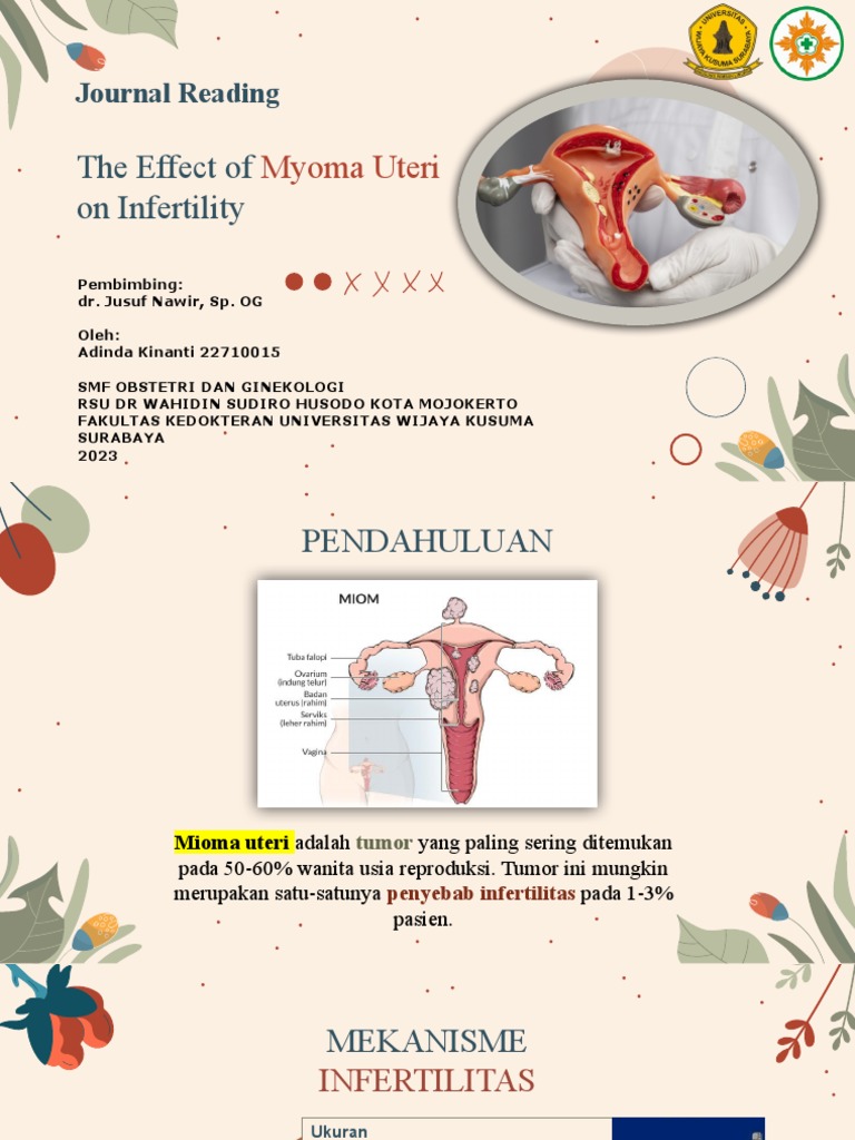 Jurnal Reading - Mioma Uteri | PDF