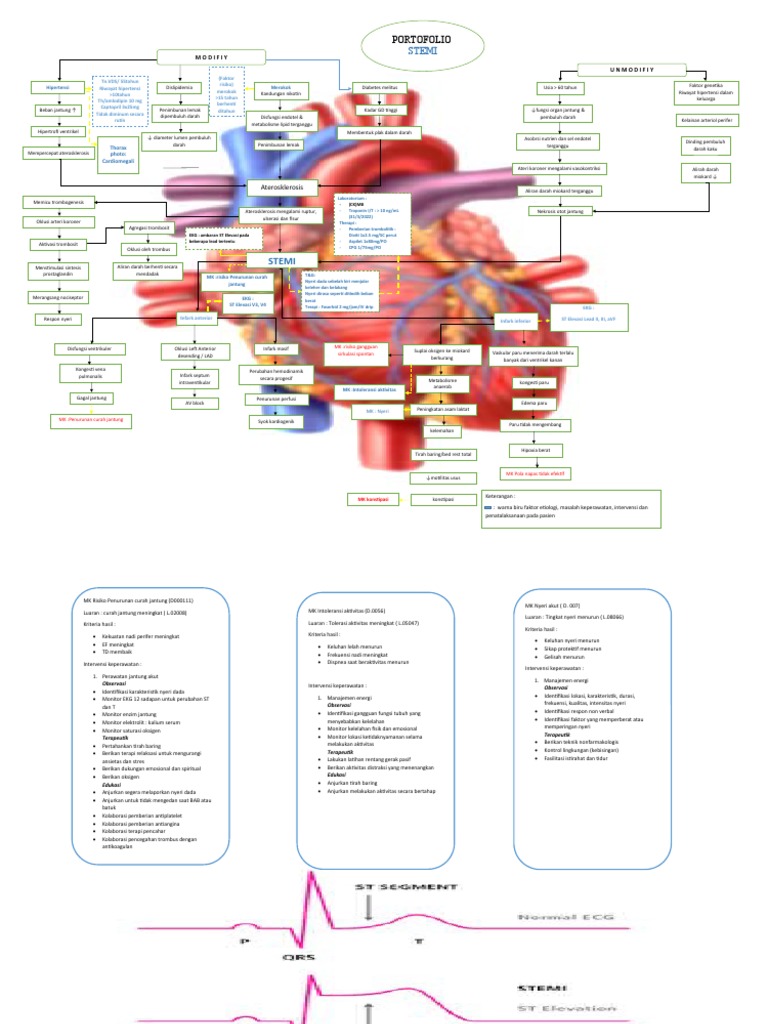 Risiko Kardiovaskular & Penanganan STEMI | PDF