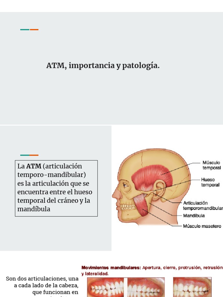 ATM Articulación Temporo Mandibular | PDF