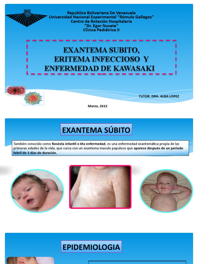 Exantema Subito, Eritema Infeccioso y Enf de Kawasaki EMILY | PDF ...